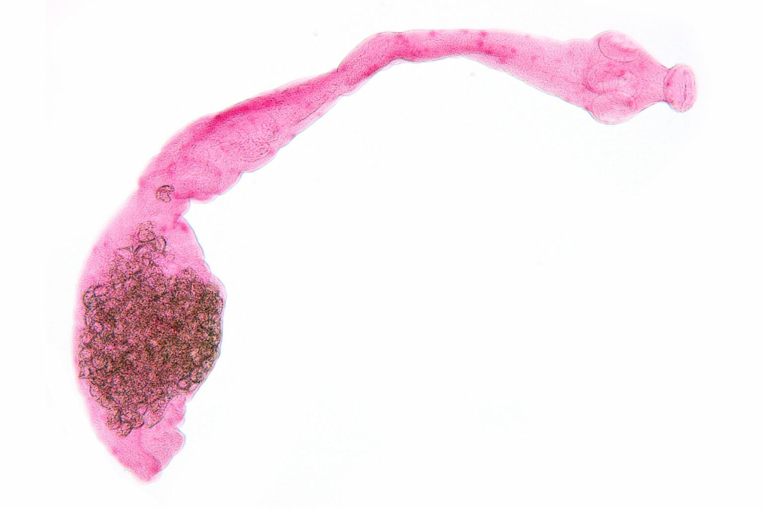 Echinococcus multilocularis - ZOWIAC EN