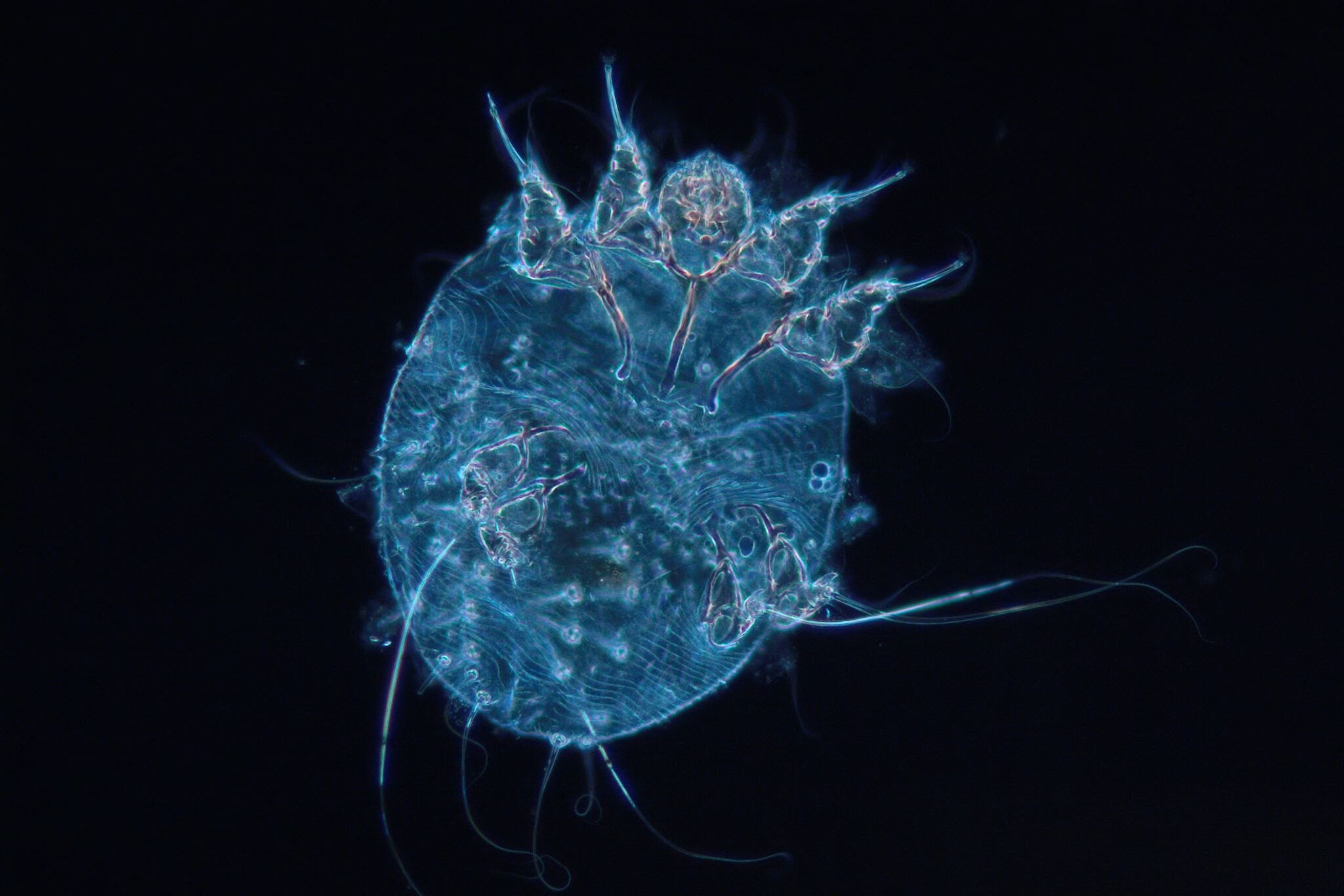 Sarcoptes scabiei - ZOWIAC